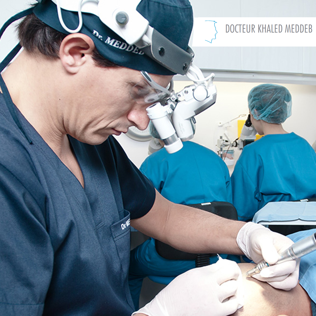 Greffe de cheveux Tunisie : Prix Implants Docteur Meddeb , devis